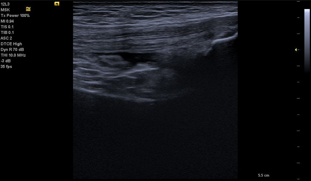 MSK Ultrasound