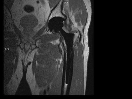 MAGNETOM Free.Max - Siemens Healthineers USA