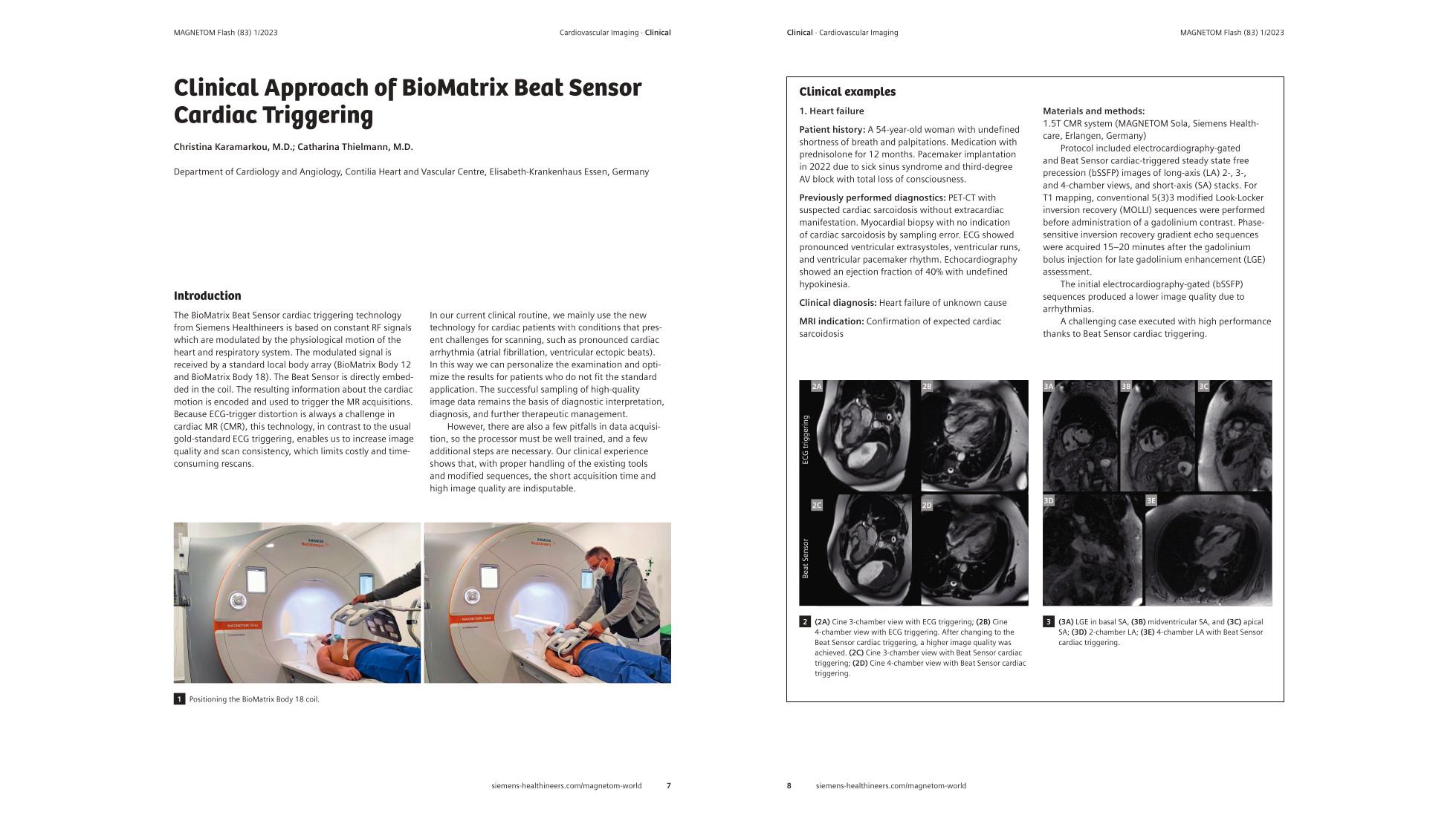 BioMatrix Beat Sensor