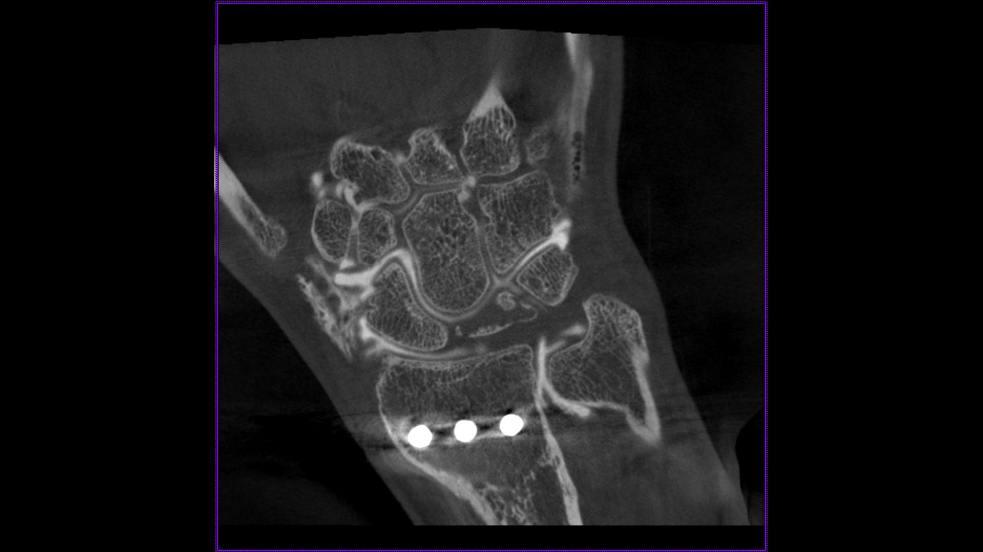 syngo DynaCT - Siemens Healthineers USA