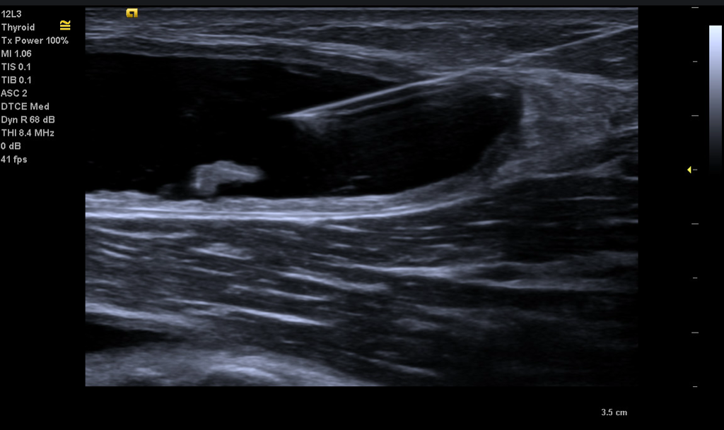 MSK Ultrasound