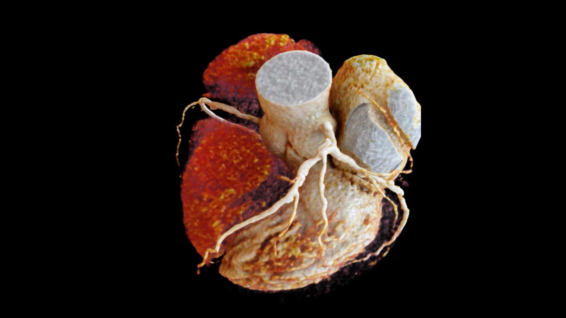 CT Customer Information Center - Siemens Healthineers Ireland