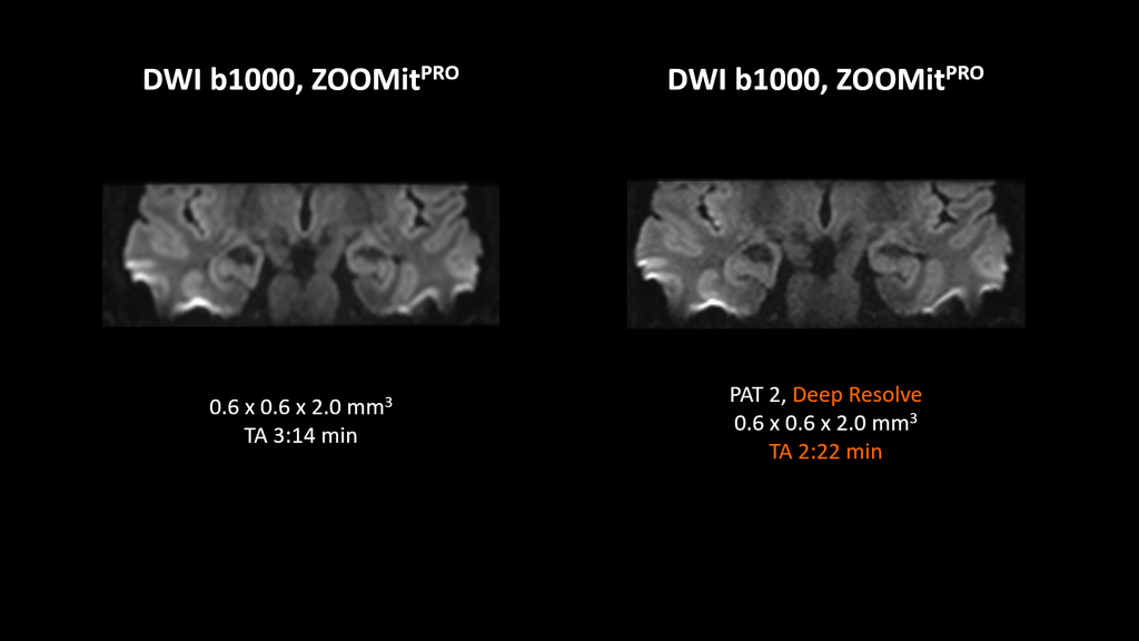 MAGNETOM Skyra Fit - Siemens Healthineers