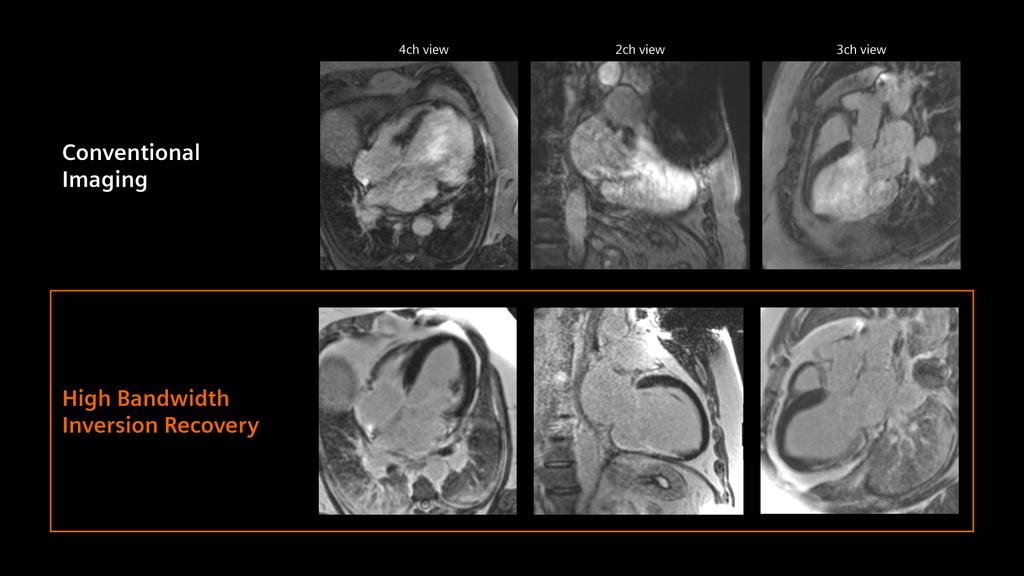 Cardiovascular MRI - Siemens Healthineers