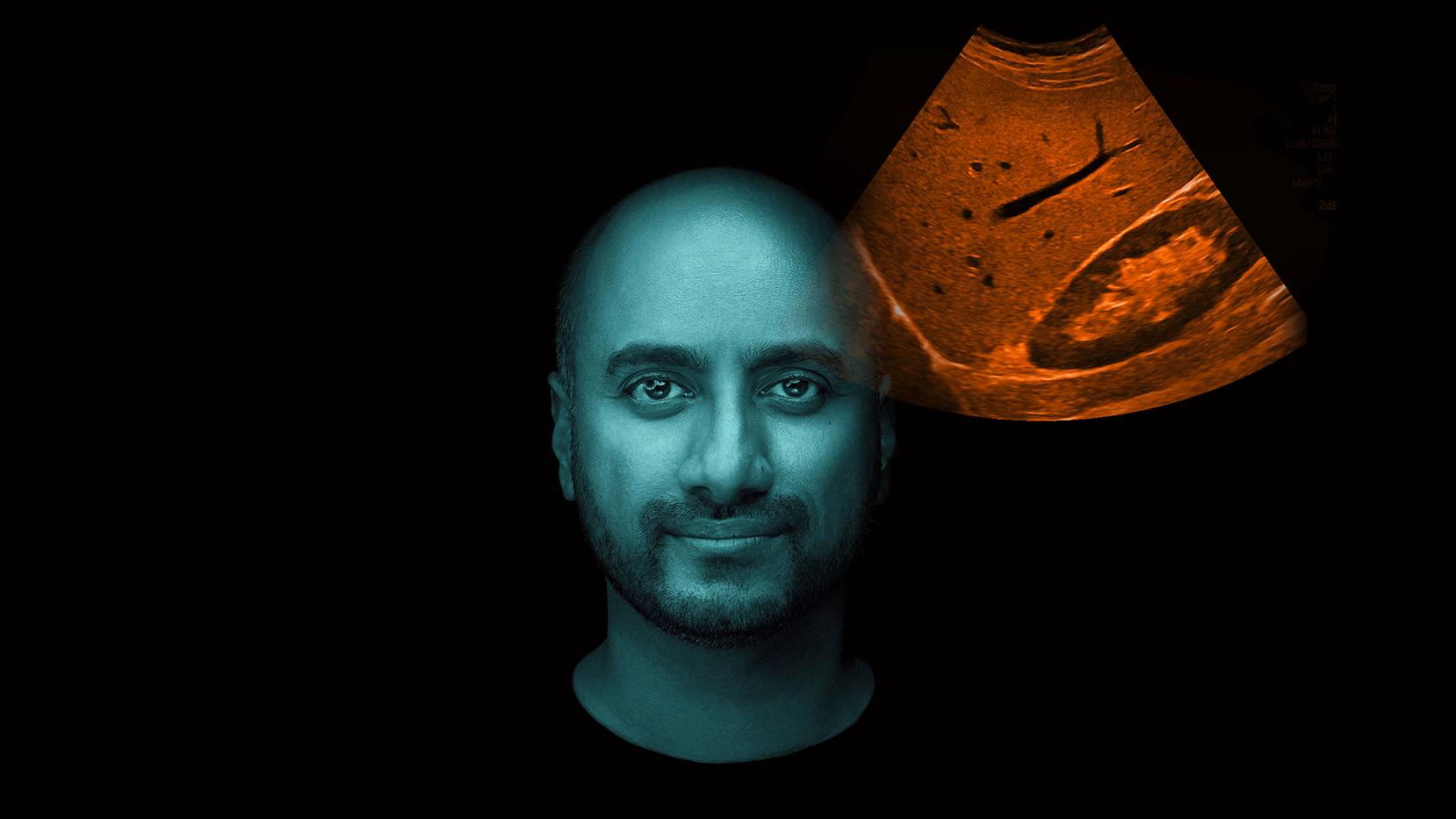 BMUS Ultrasound 2025 - Siemens Healthineers