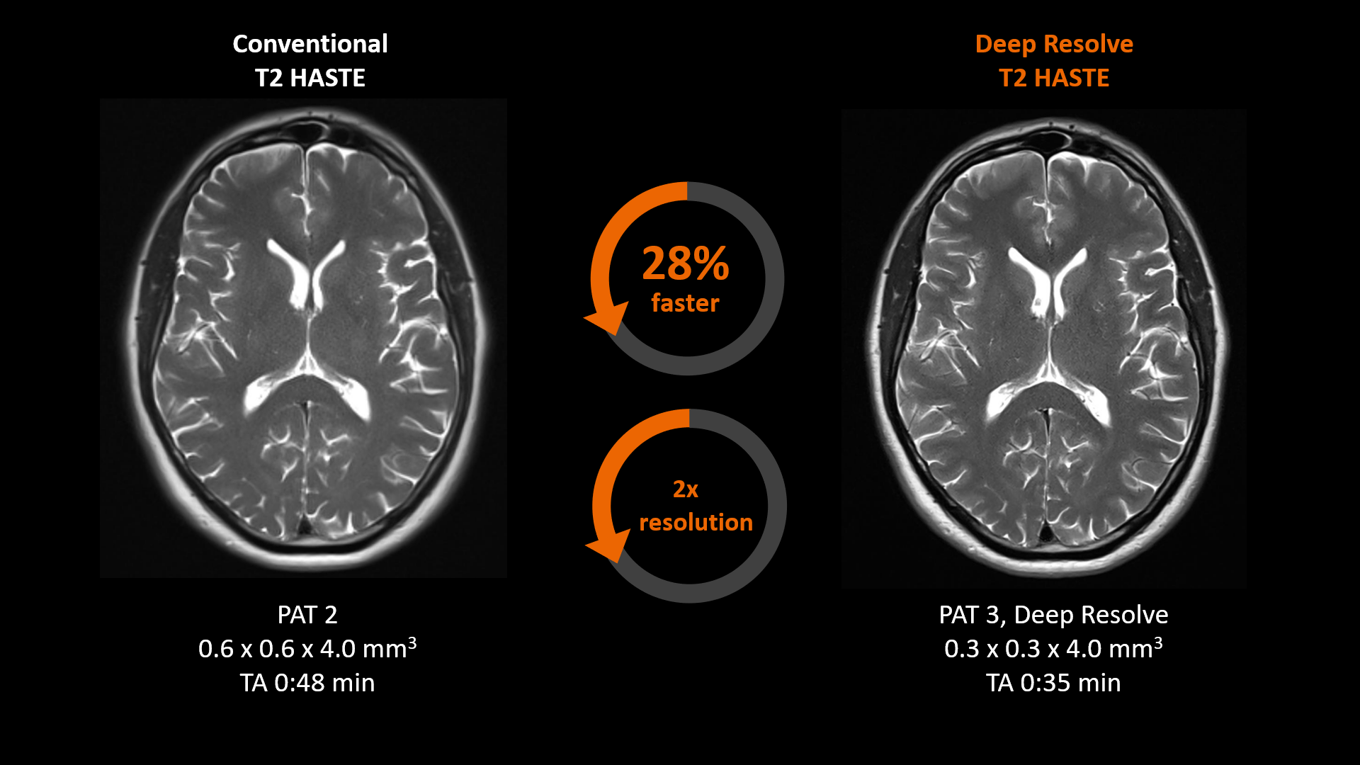 MAGNETOM Skyra Fit - Siemens Healthineers