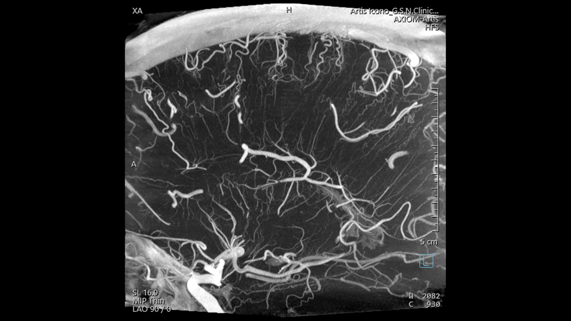 syngo DynaCT - Siemens Healthineers USA