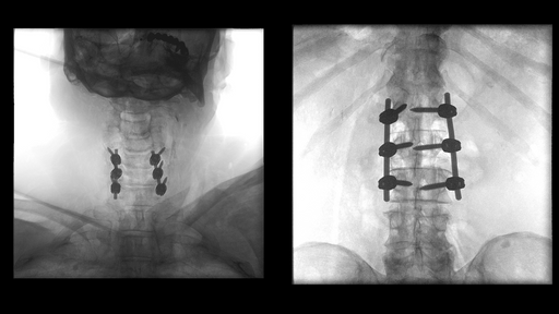 Cios Flow - Siemens Healthineers USA