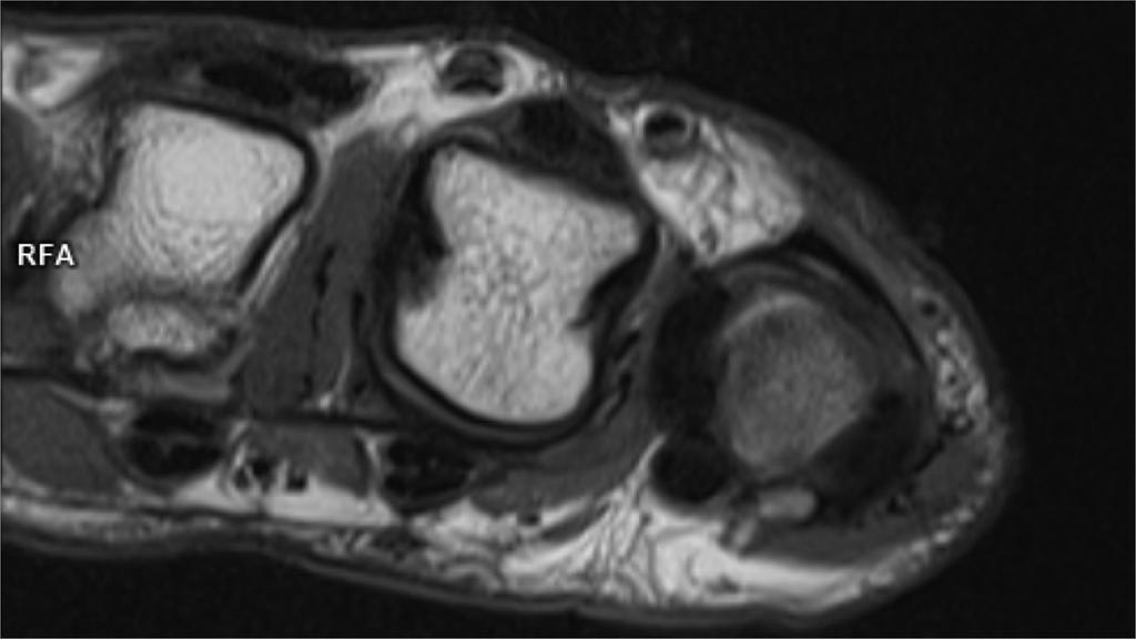 Axial T1-MAGNETOM Altea - Siemens Healthineers USA