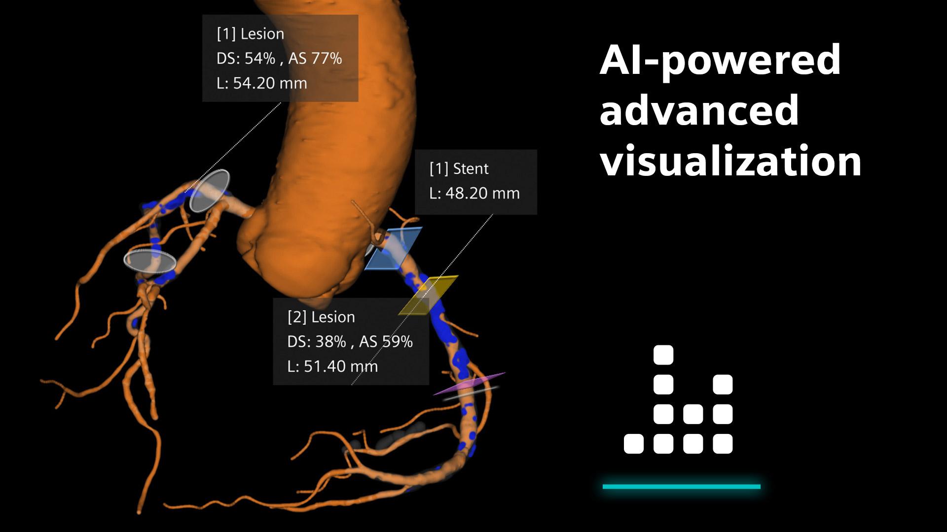 AI-powered Productivity in Photon-counting CT | NAEOTOM Alpha class ...