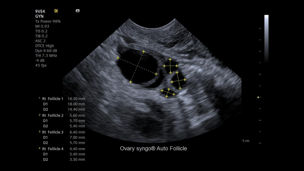 ACUSON Maple is a High-Performance Shared Service Ultrasound System ...