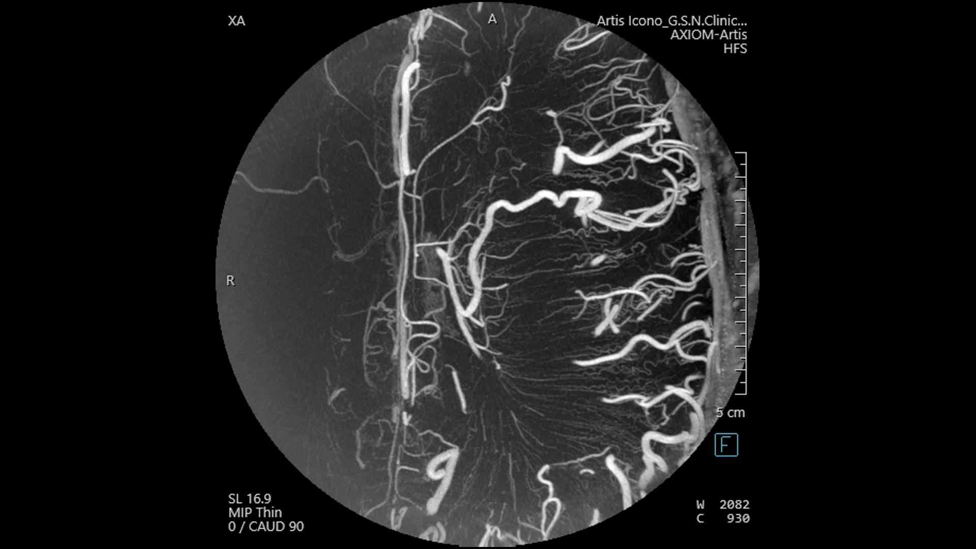 syngo DynaCT - Siemens Healthineers