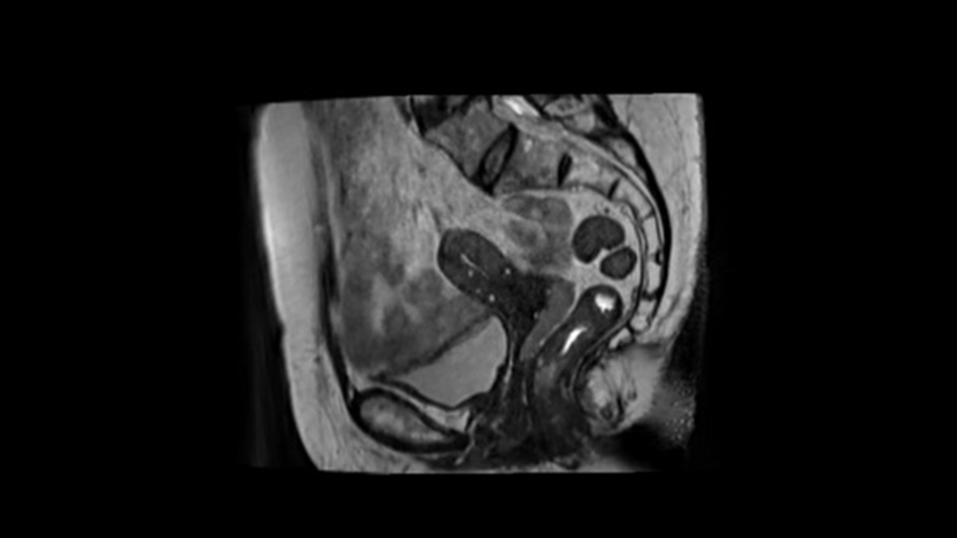 MAGNETOM Flow RT Pro Edition - Siemens Healthineers