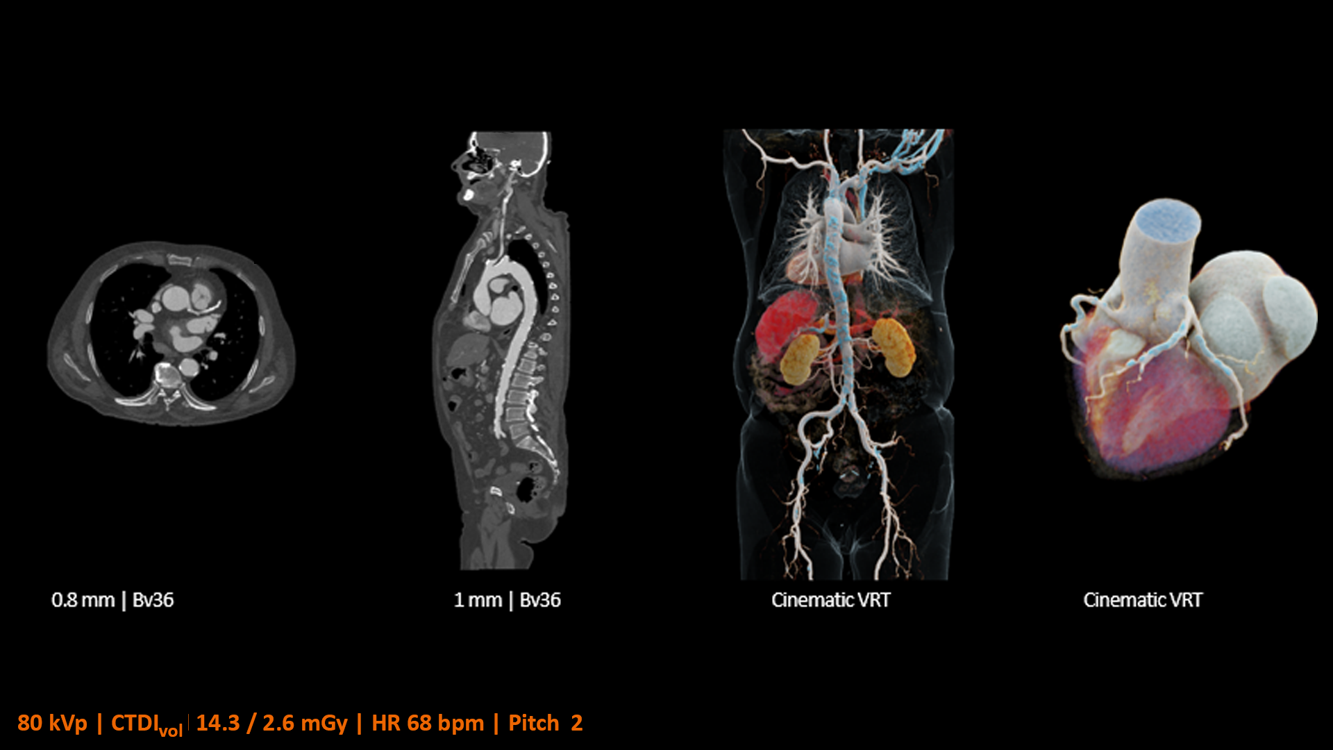 Dual Source CT - Siemens Healthineers