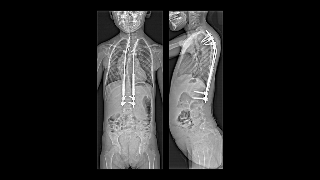 Twin Robotic X-ray scanner – Multitom Rax - Siemens Healthineers