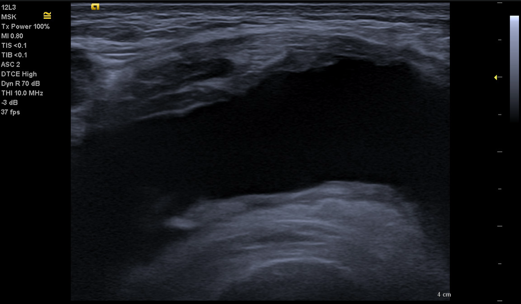 MSK Ultrasound
