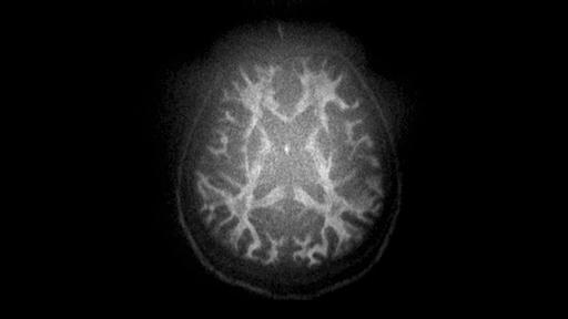 脳神経領域の高度な研究ニーズに応えるMRI装置「MAGNETOM Cima.X」販売開始 - Siemens Healthineers Japan