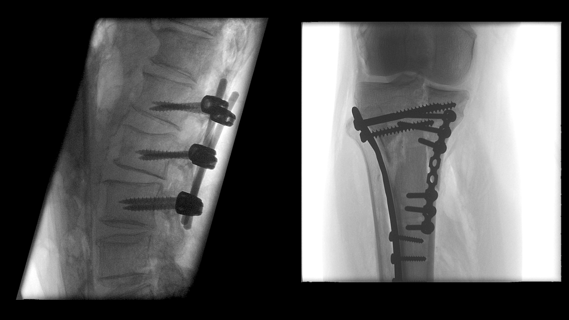 Cios Flow - Siemens Healthineers USA