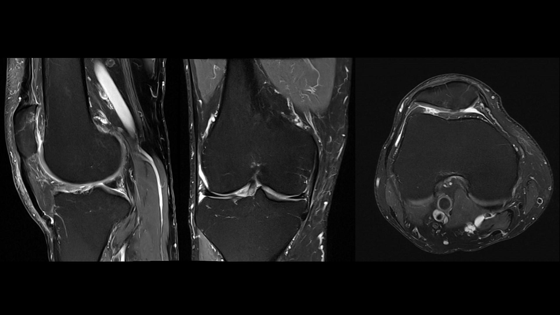 BioMatrix Contour Coils - Siemens Healthineers