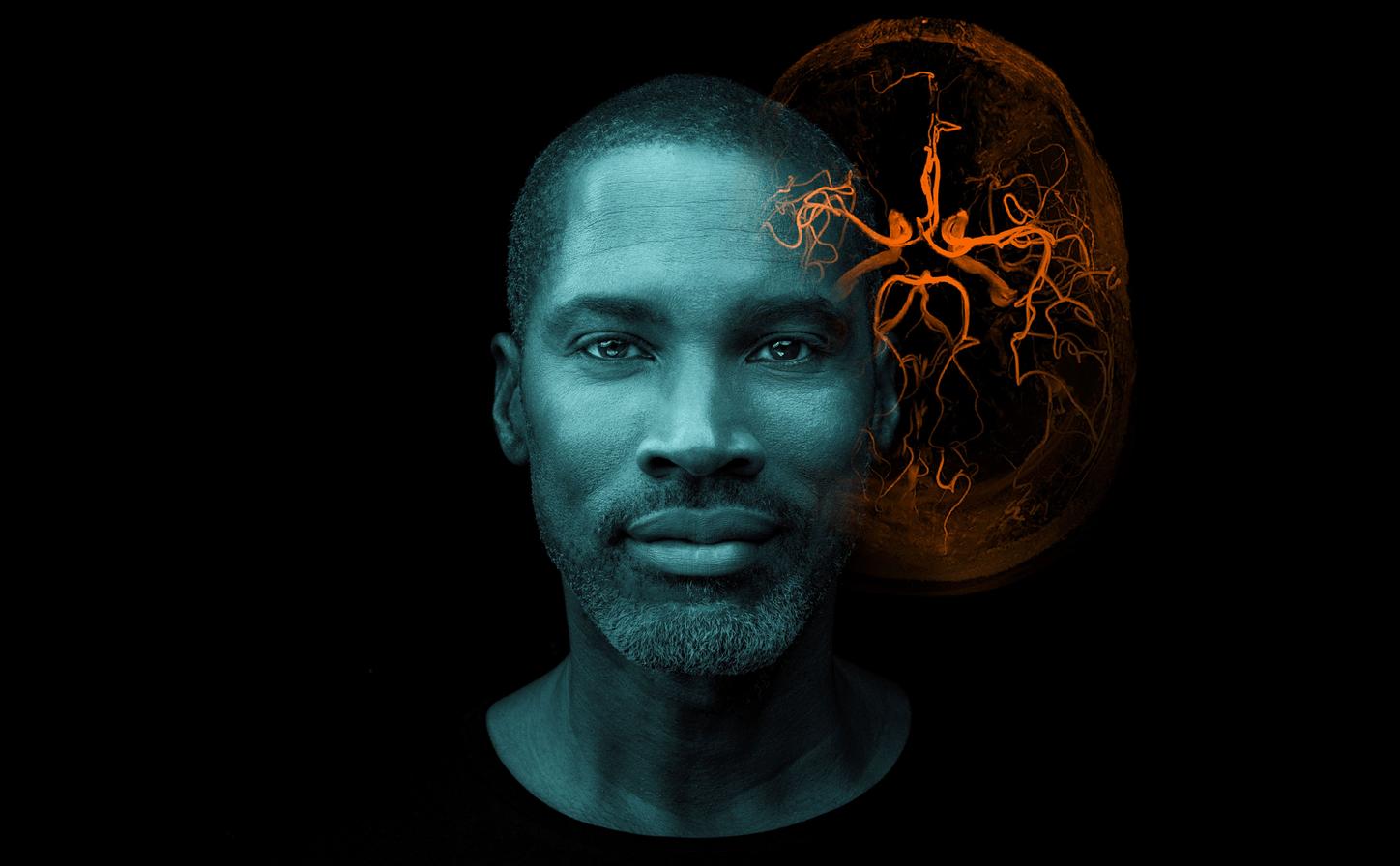 There's a better way to see the brain - Siemens Healthineers USA