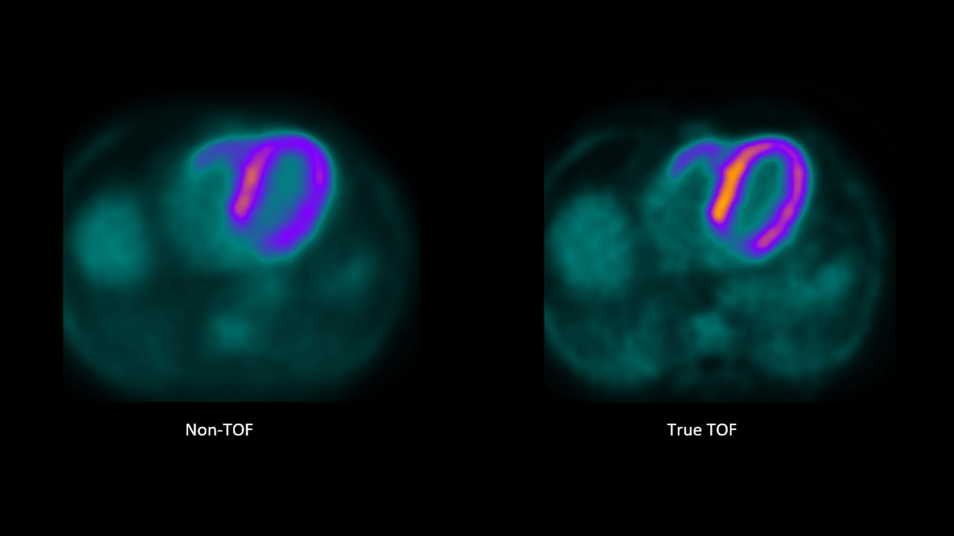 Biograph Horizon PET/CT scanner - Siemens Healthineers