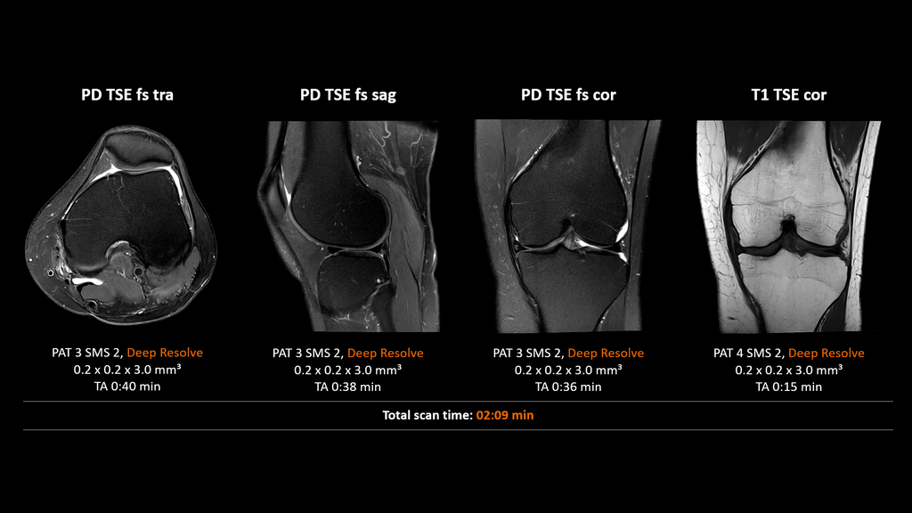 Musculoskeletal Imaging - Siemens Healthineers