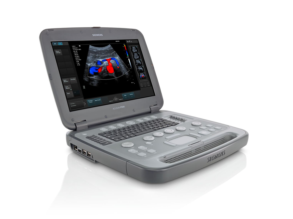 ACUSON Ultrasound Machines - Siemens Healthineers