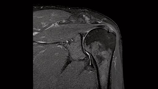 MAGNETOM Free.Max – Open Bore MRI - Siemens Healthineers USA