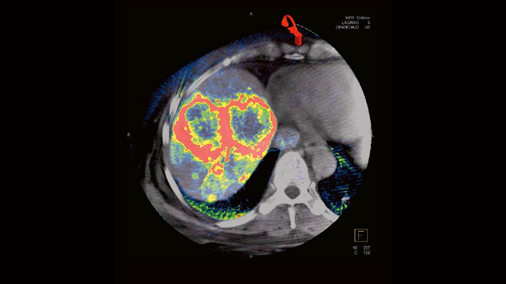 Artis Q - Siemens Healthineers