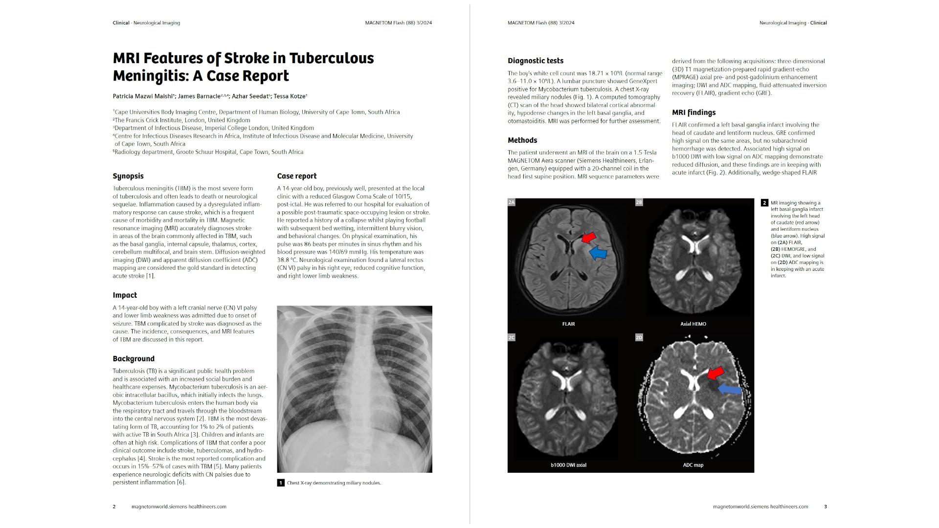 MRI Case Studies, MRI Case Study, MRI Case