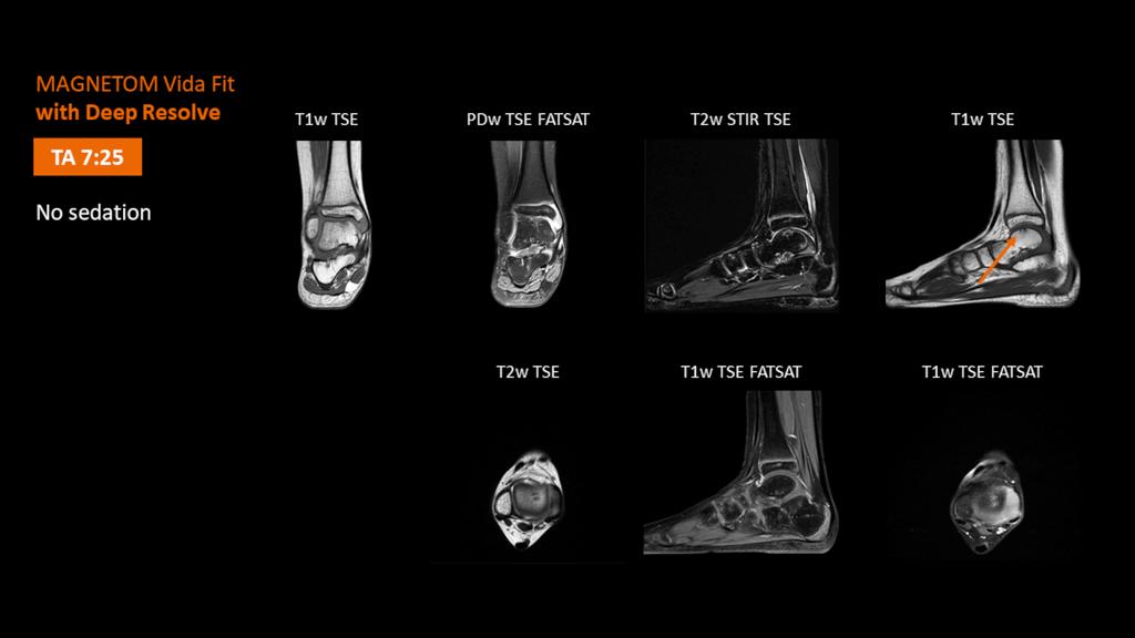 Pediatric MRI - Siemens Healthineers