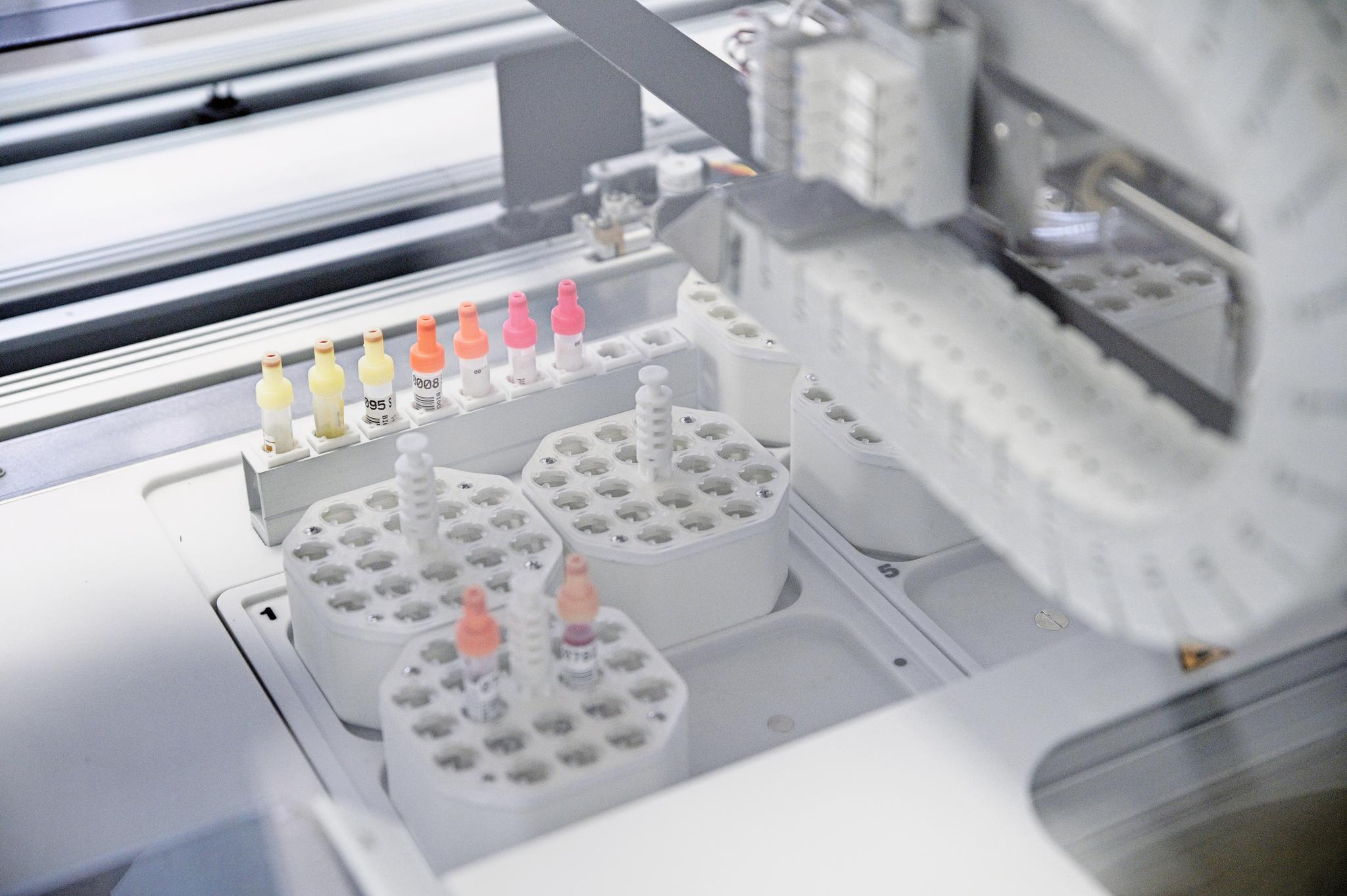 Laboratorní vzorky ve FN Ostrava zpracovává plně automatická linka ...