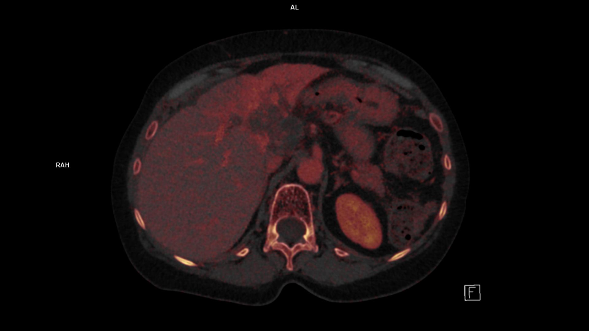 SOMATOM Pro.Pulse Dual Source CT scanner - Siemens Healthineers