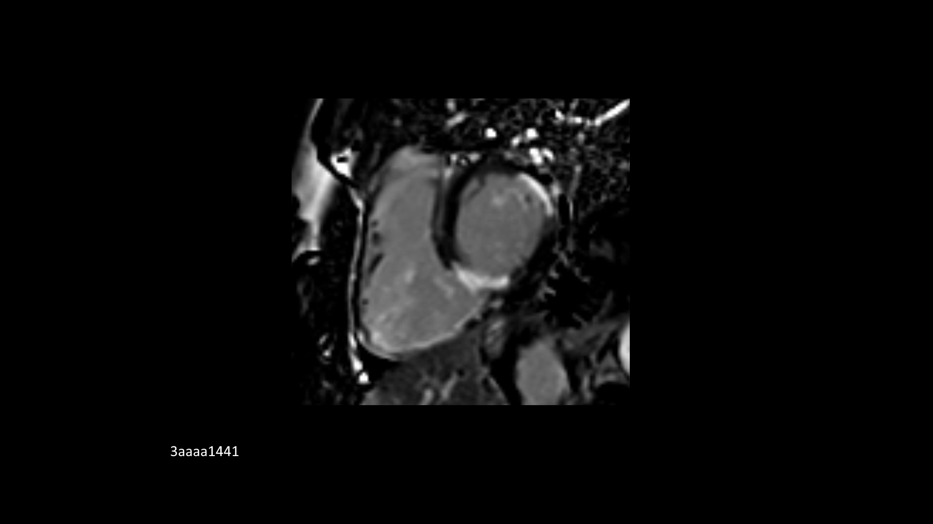 MAGNETOM Vida Fit - Siemens Healthineers