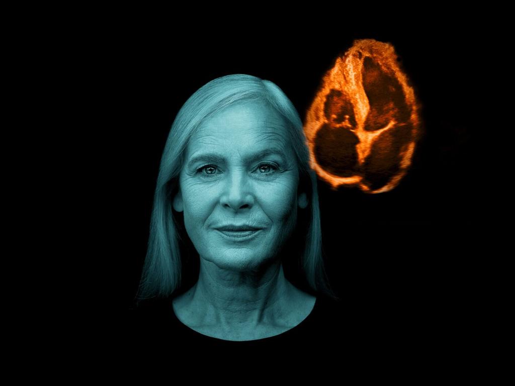 Siemens Healthineers at the PSE 27th Annual Convention - Siemens ...