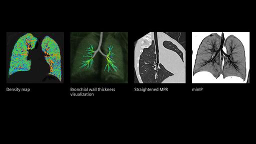 PCCT pediatric imaging - Siemens Healthineers USA