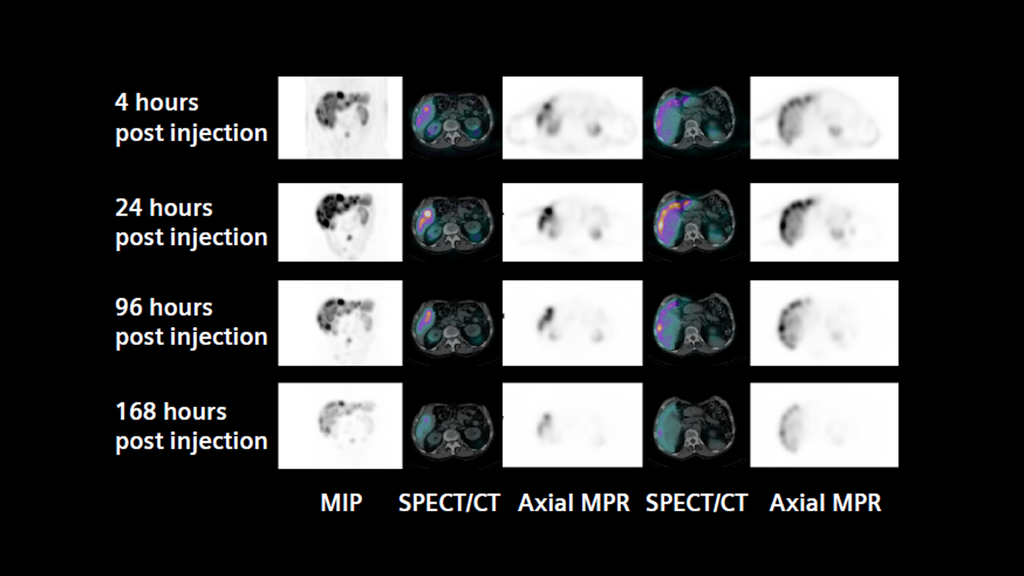 xSPECT Quant for the reproducible quantification of tracer ...