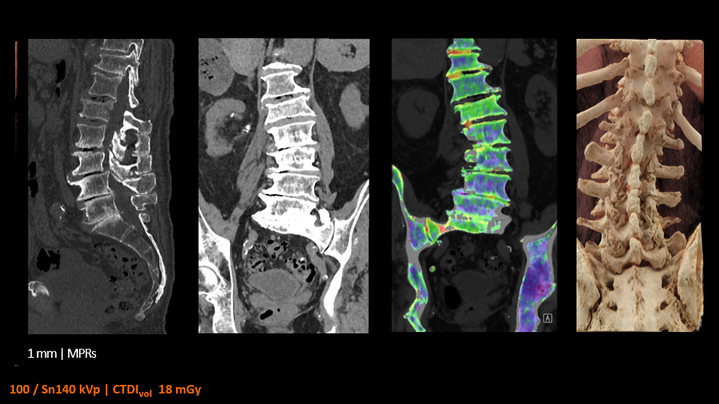 Dual Source CT - Siemens Healthineers