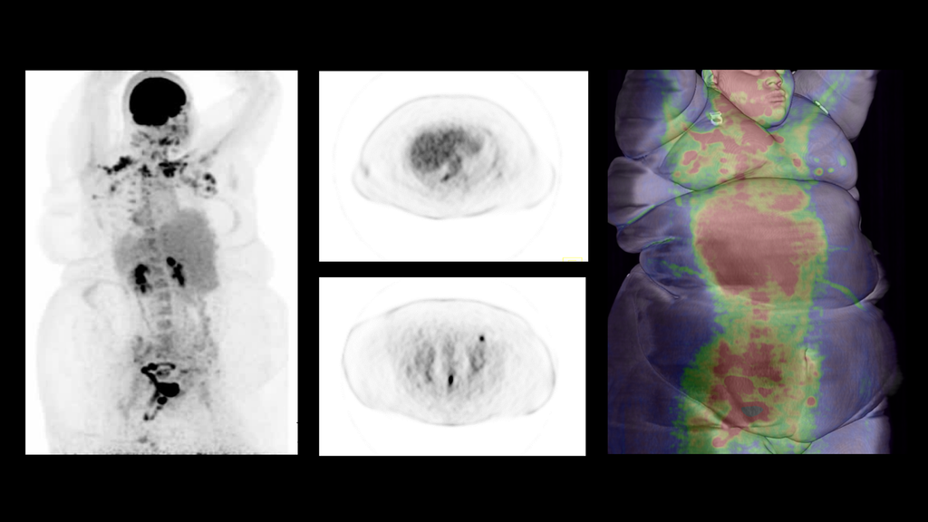Biograph mCT PET/CT scanner - Siemens Healthineers USA