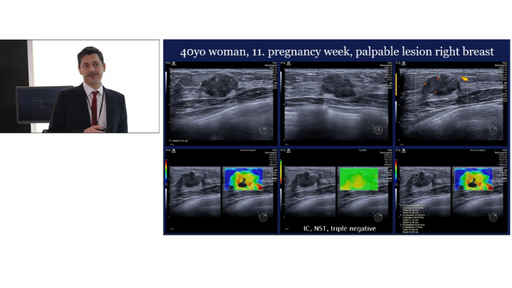 Women's Health Ultrasound Systems - Siemens Healthineers USA