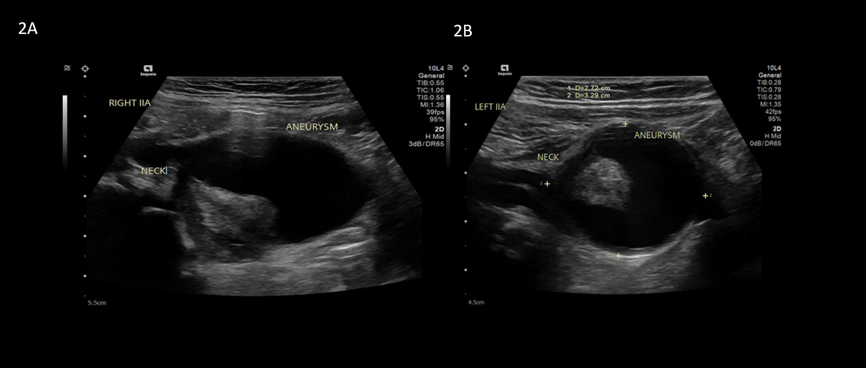New Technologies help in Rare Ultrasound Case Studies