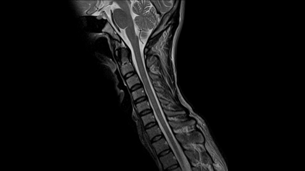 MAGNETOM Free.Star - Siemens Healthineers