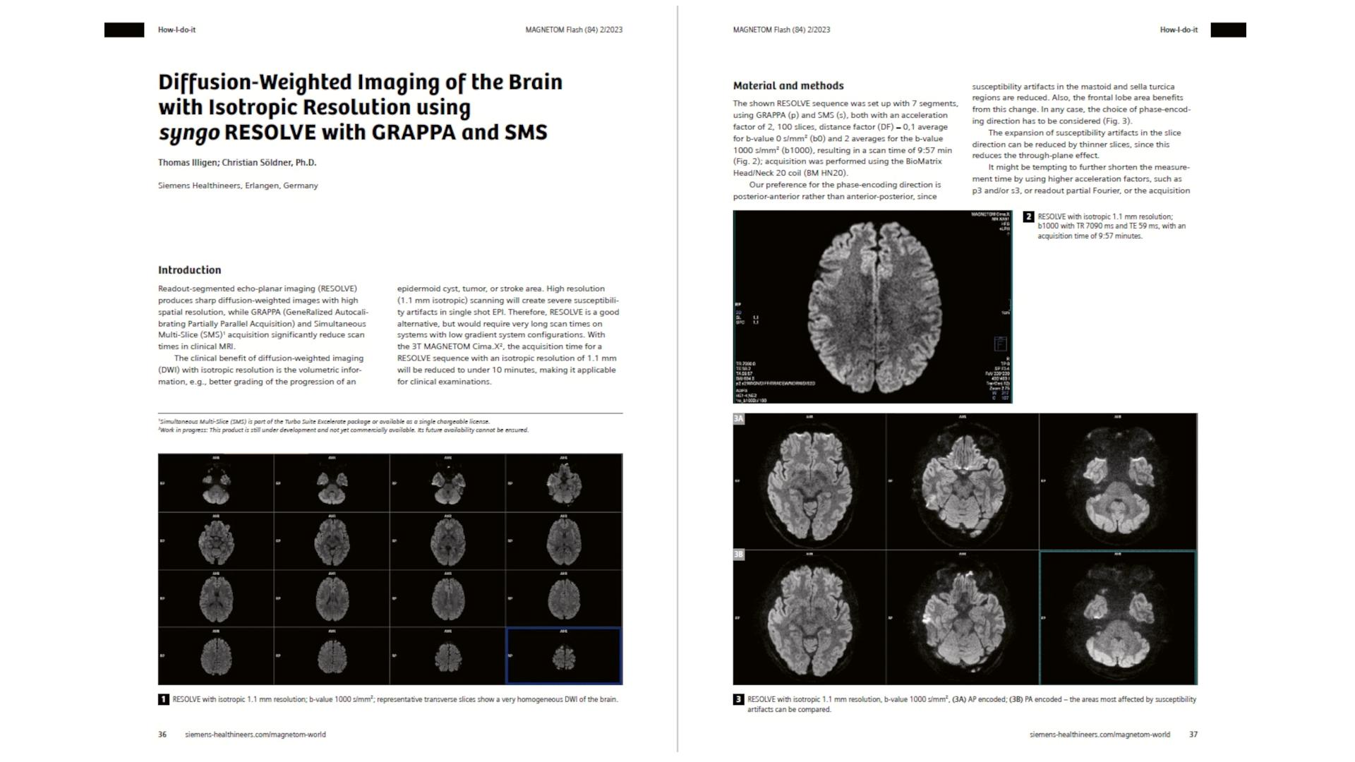 MRI Case Studies, MRI Case Study, MRI Case