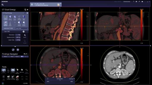 Computed Tomography - Siemens Healthineers