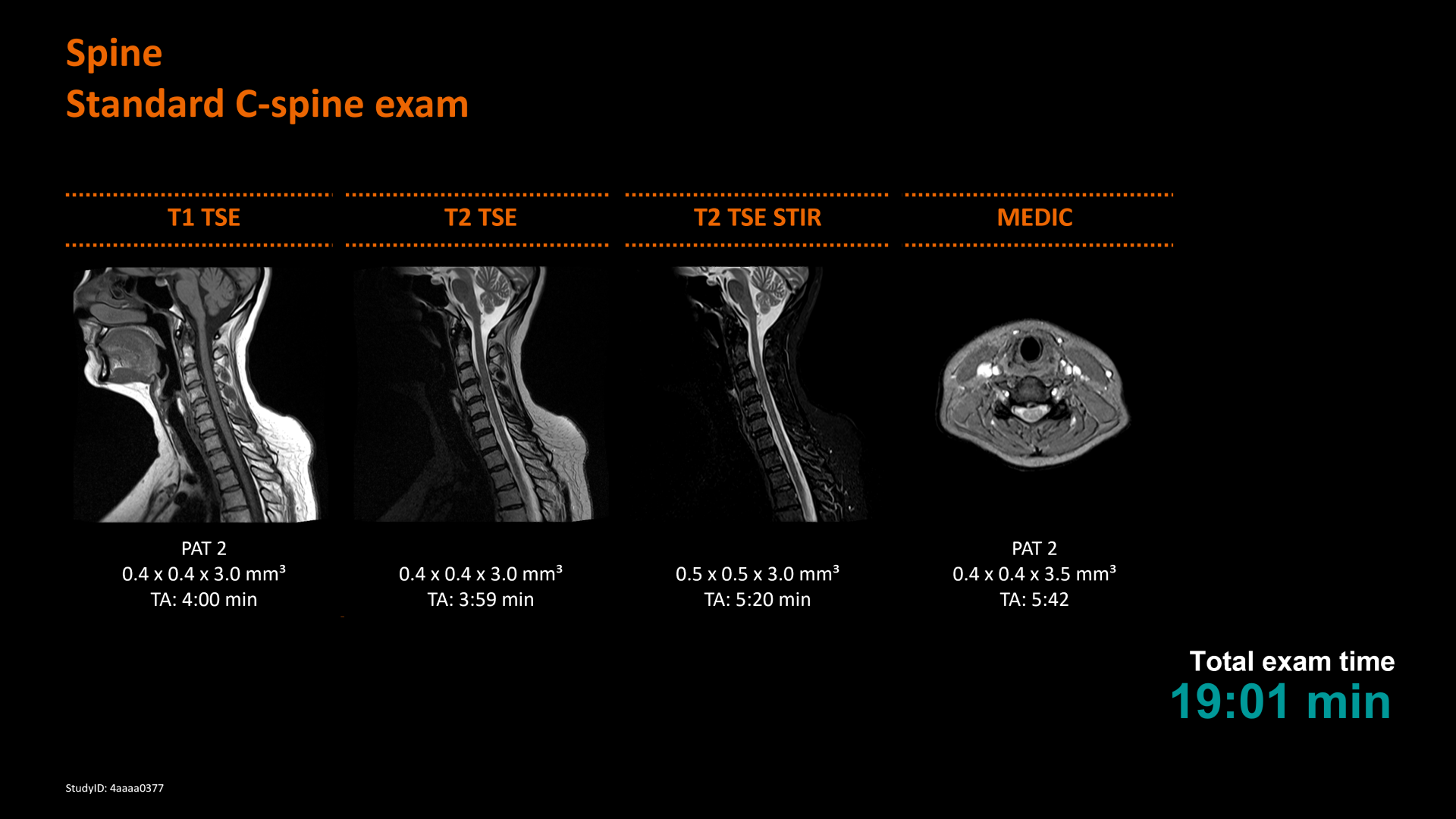 MAGNETOM Free.Star - Confiança no diagnóstico para a excelência diária ...