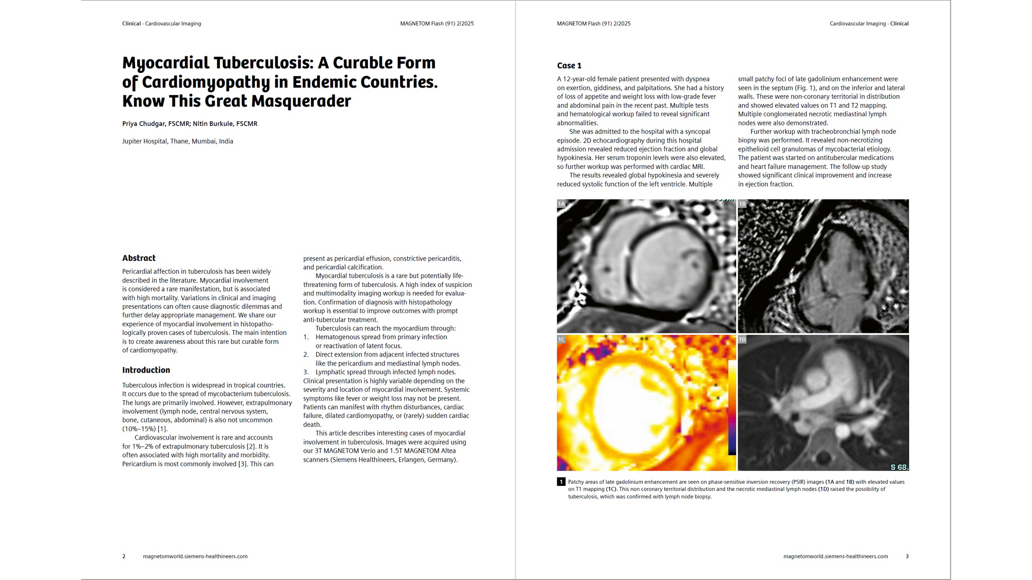 MRI Case Studies, MRI Case Study, MRI Case
