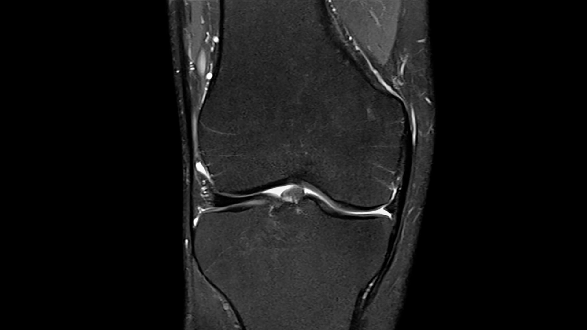 Phoenix Images for MAGNETOM Sola 1.5T