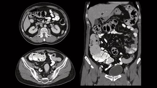 The Siemens Healthineers CT Imaging Chain - Siemens Healthineers