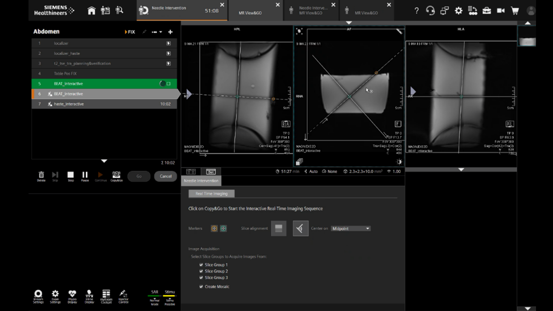Options & Upgrades - Get the most from your investment - Siemens ...