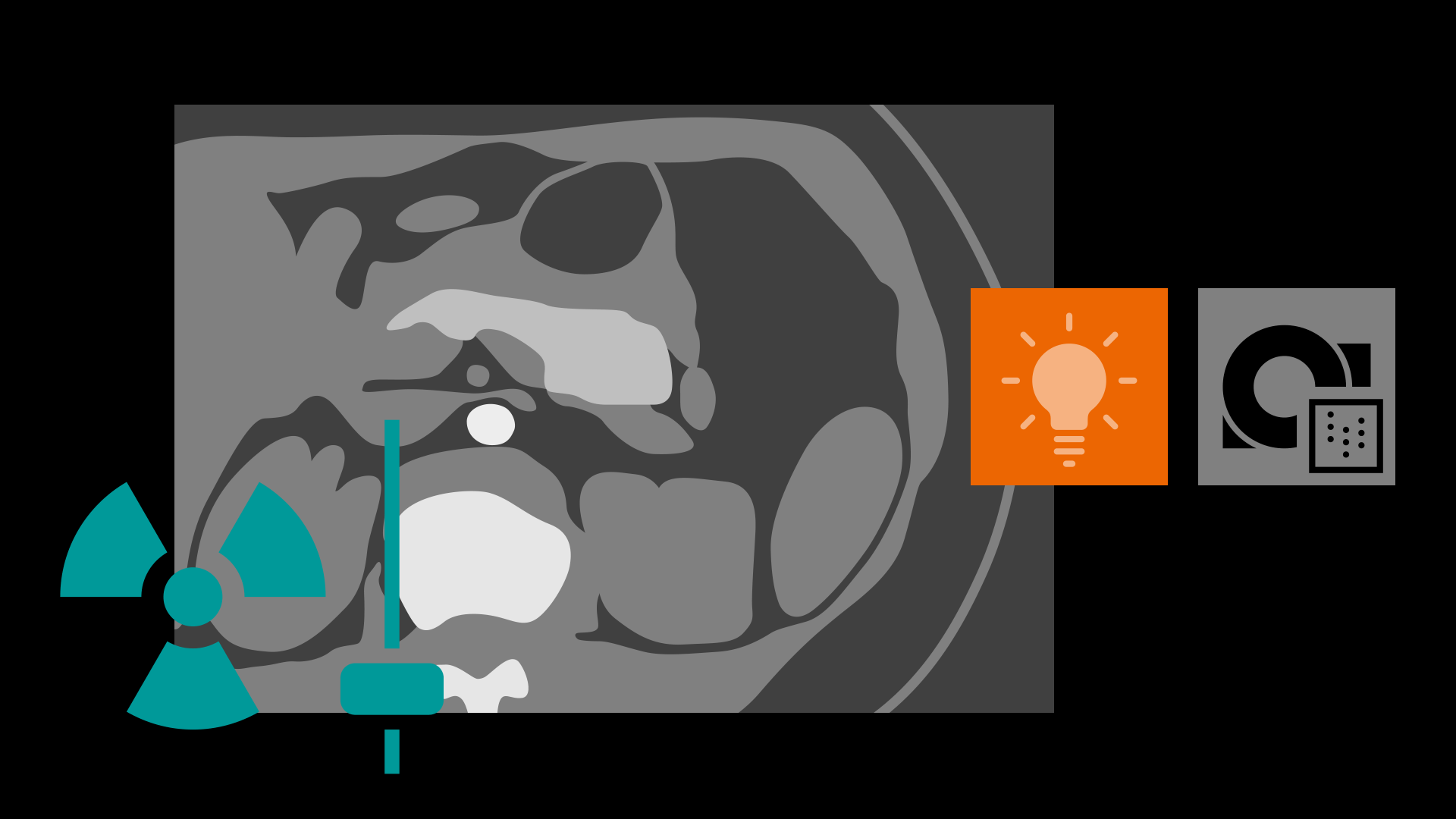 Inter‑reader agreement of pancreatic adenocarcinoma resectability ...